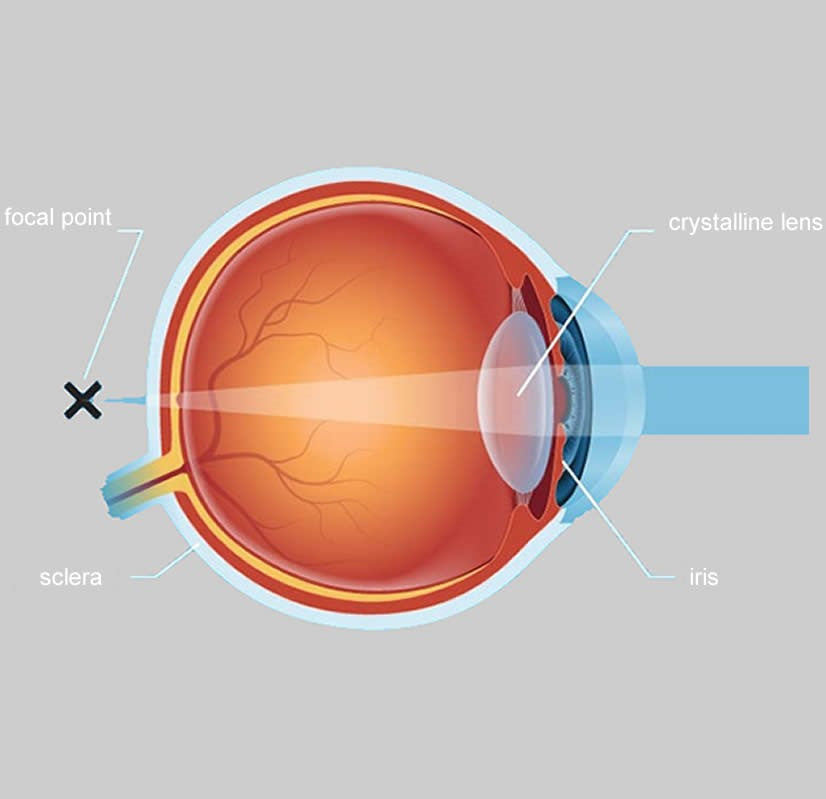 Corrective, Multifocal & Contact Lenses For Presbyopia - Eyecare People